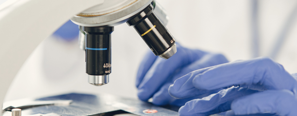 Laboratoriniai kraujo tyrimai | Inovatyvios Dermatologijos Centras